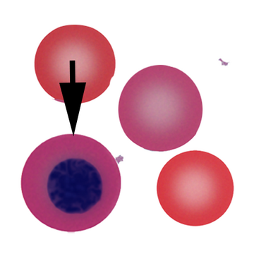 Nucleated Red Cells (nRBC) - haematologyetc.co.uk