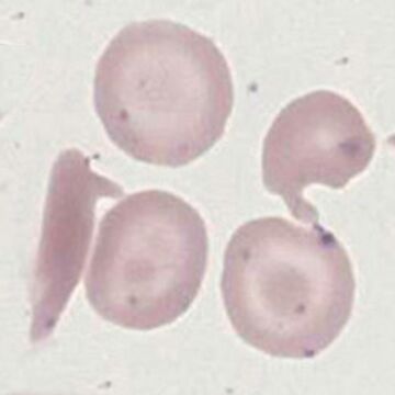 SC poikilocytes - haematologyetc.co.uk