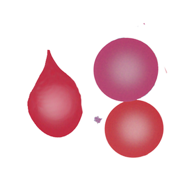 Teardrop cells - haematologyetc.co.uk