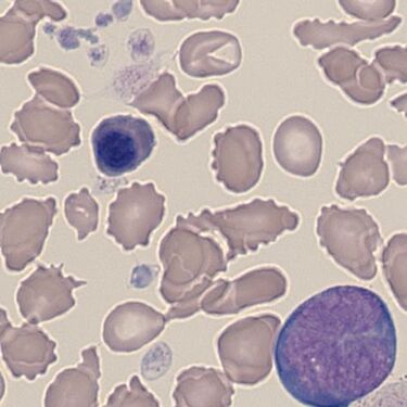 Nucleated Red Cells (nRBC) - haematologyetc.co.uk
