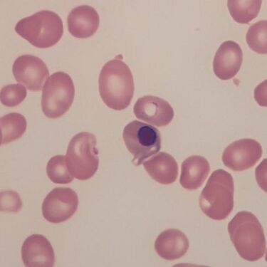 Nucleated Red Cells (nRBC) - haematologyetc.co.uk
