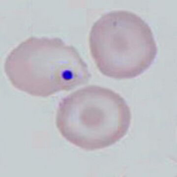 Howell Jolly bodies - haematologyetc.co.uk