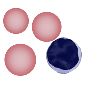 Microcytic and Hypochromic Red Cells - haematologyetc.co.uk