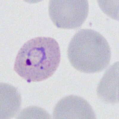 Schüffner's dots - haematologyetc.co.uk