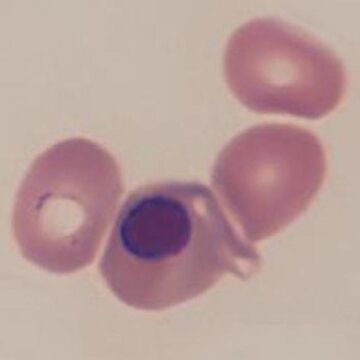 Nucleated Red Cells (nRBC) - haematologyetc.co.uk