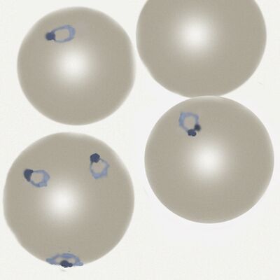 Plasmodium falciparum: Morphology - haematologyetc.co.uk