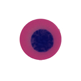 Image Index of red cell forms - haematologyetc.co.uk