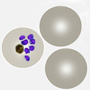 Plasmodium falciparum: Morphology - haematologyetc.co.uk
