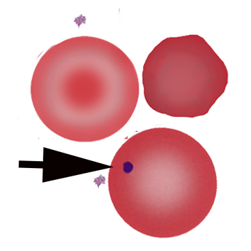 Howell Jolly bodies - haematologyetc.co.uk