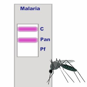 Malaria Index - haematologyetc.co.uk