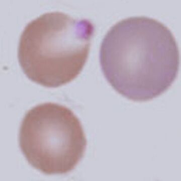 Polychromatic Red Cells - haematologyetc.co.uk