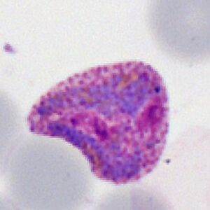 Schüffner's dots - haematologyetc.co.uk